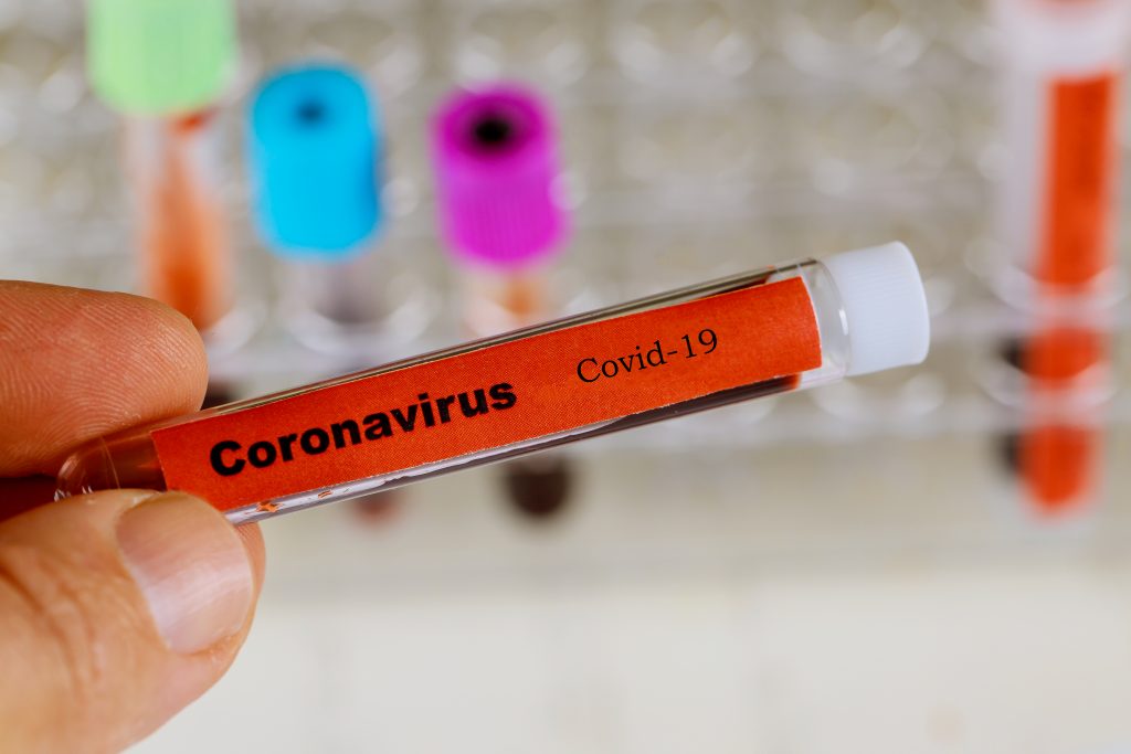 Ισπανία: Aρνητικό τεστ για τον νέο κορονοϊό ή πιστοποιητικό πλήρους ...