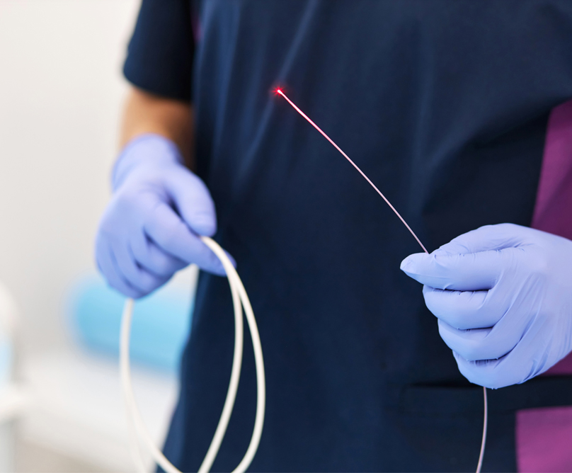 Ενδοαυλική θεραπεία με laser: Αντιμετώπιση κιρσών και φλεβικής ...